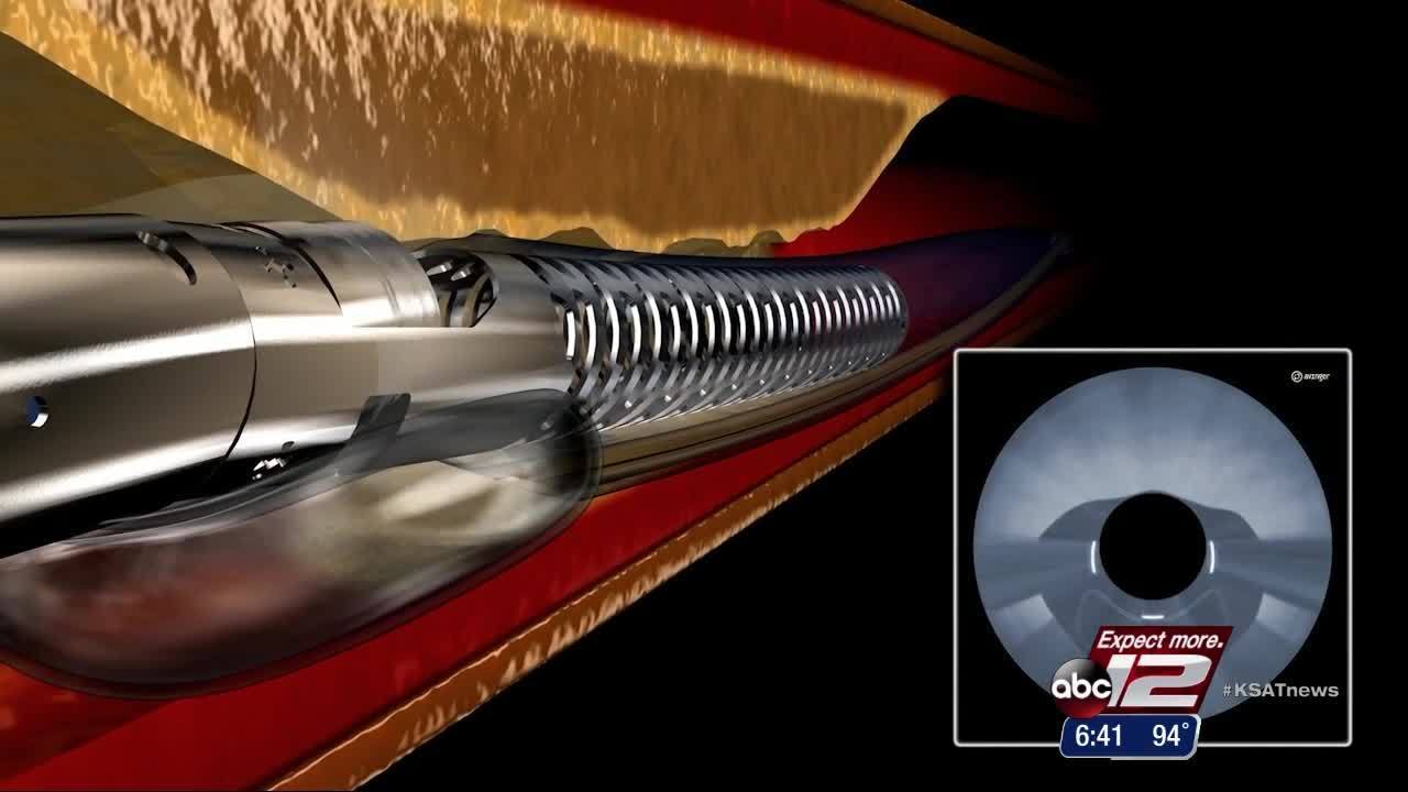 Peripheral artery disease patient first to use new device,...