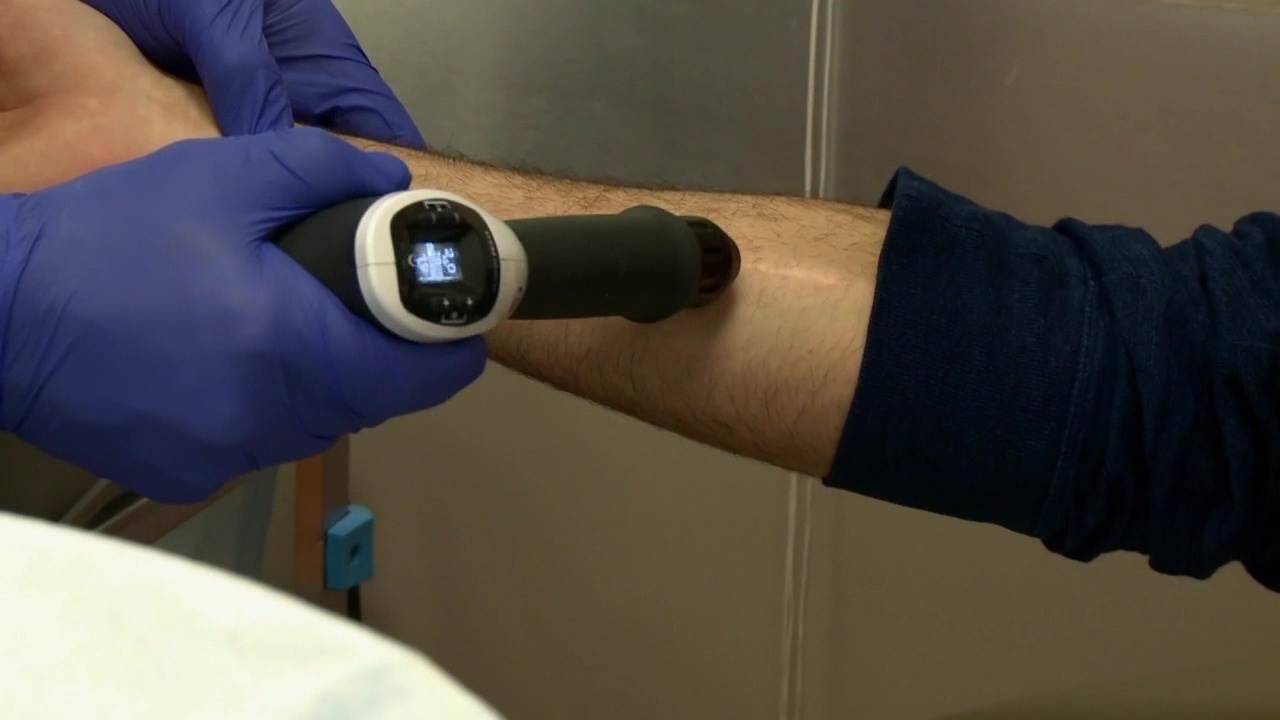 Shock wave therapy treatment used for erectile dysfunction