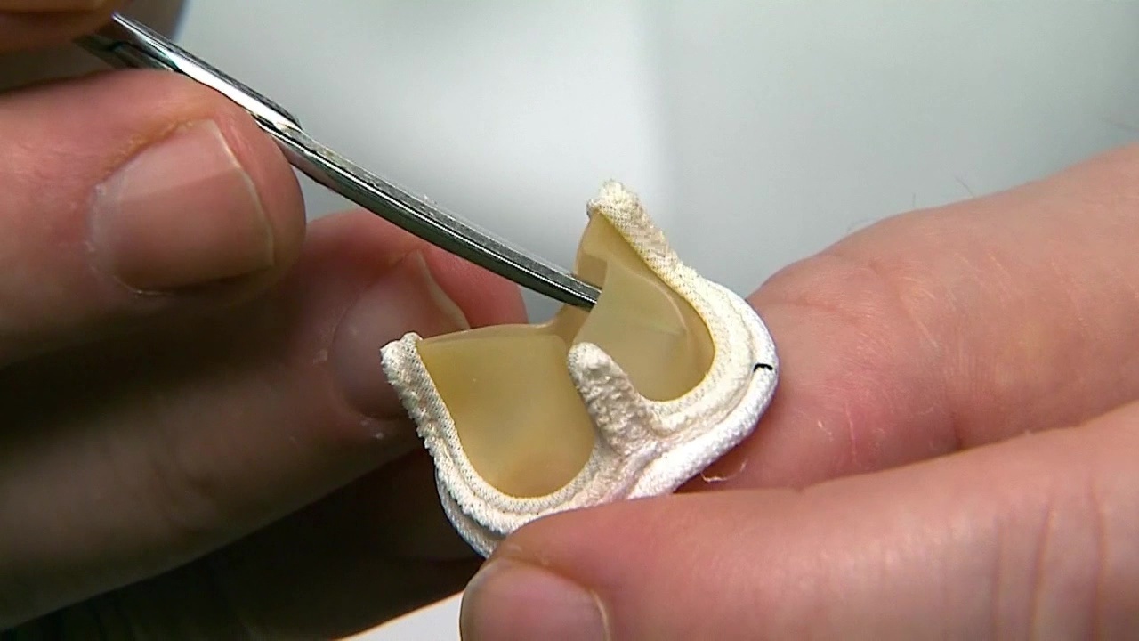 Biological Heart Valve for Young Patients